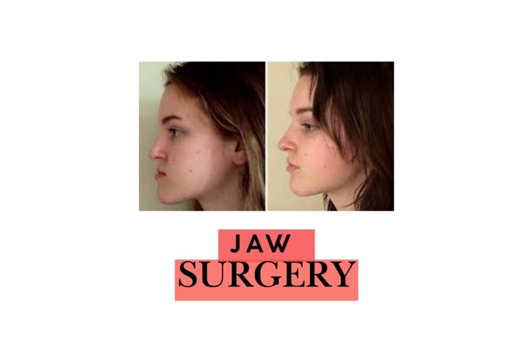 How Corrective Jaw Surgery Can Improve Facial Harmony